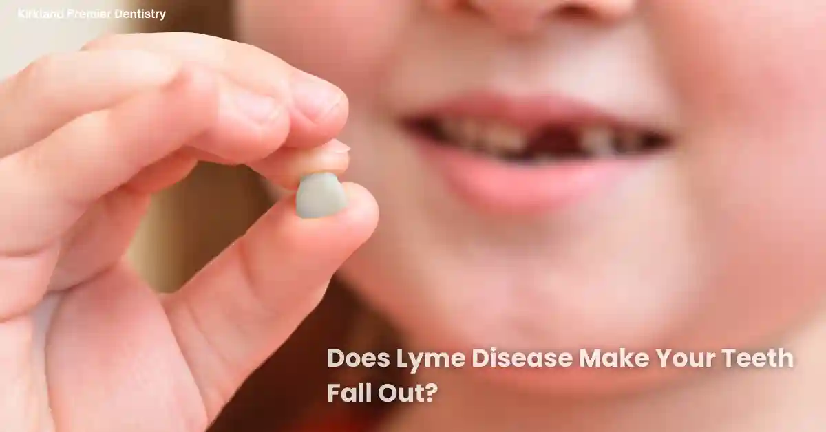 Does Lyme Disease Make Your Teeth Fall Out? | Tech Nova Sprint